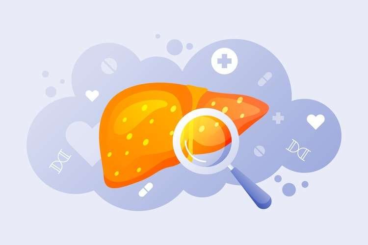 Hepatitis A: Todo lo que debes saber sobre esta enfermedad